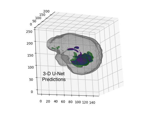 3-D Segmentation of Brain MRIs · James Braza