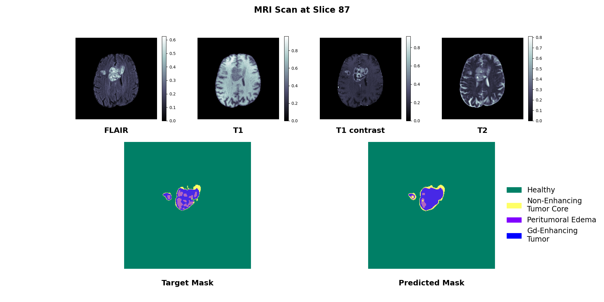 3-D Segmentation of Brain MRIs · James Braza